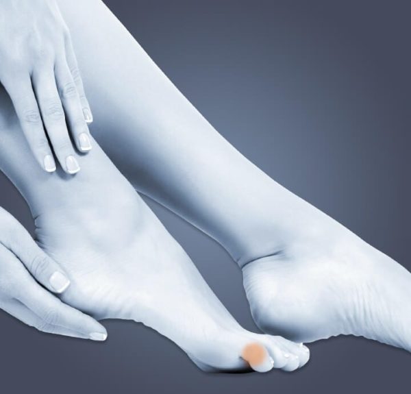 Causes et traitements des cors sur les pieds | Dr. Scholl's